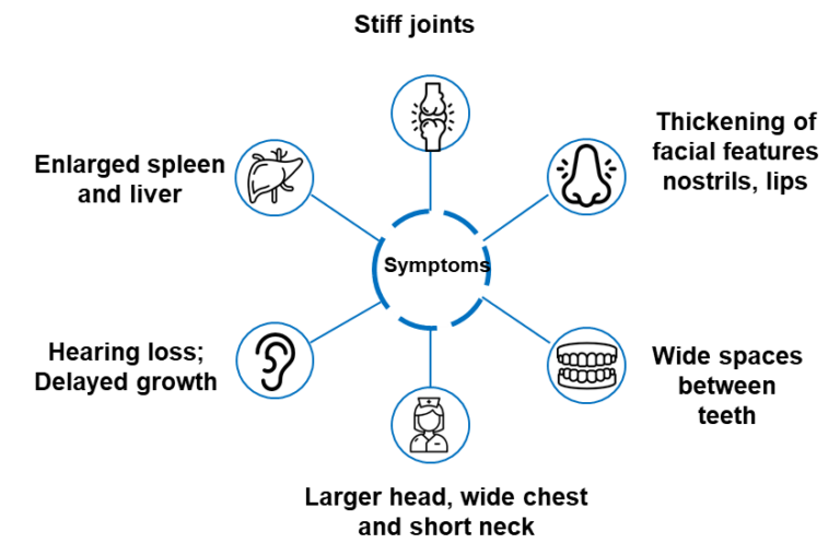 Hunter Syndrome: Epidemiology, Treatment and Clinical Pipeline | Stellarix